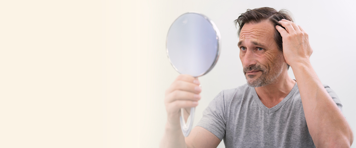 Baldness & Receding Hairline, Treatments - Doctor's Apothecary